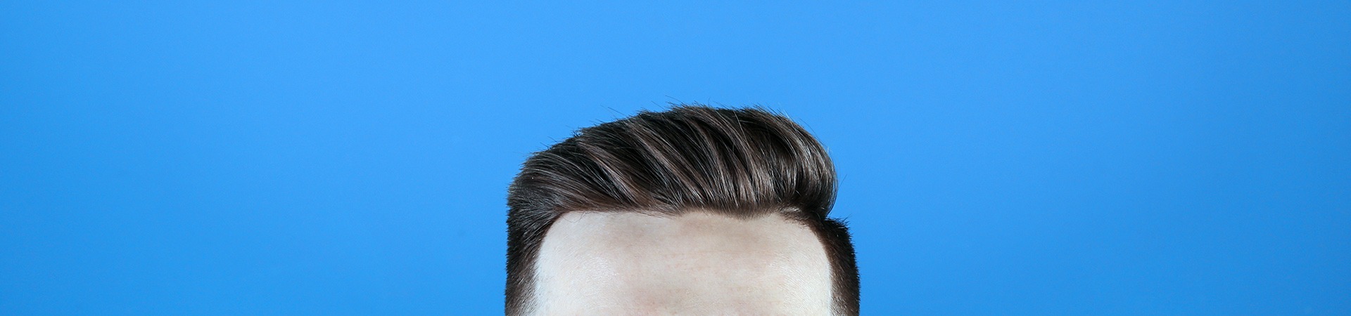 Greffe de cheveux - Implants Capillaires - Chirurgie et médecine ...